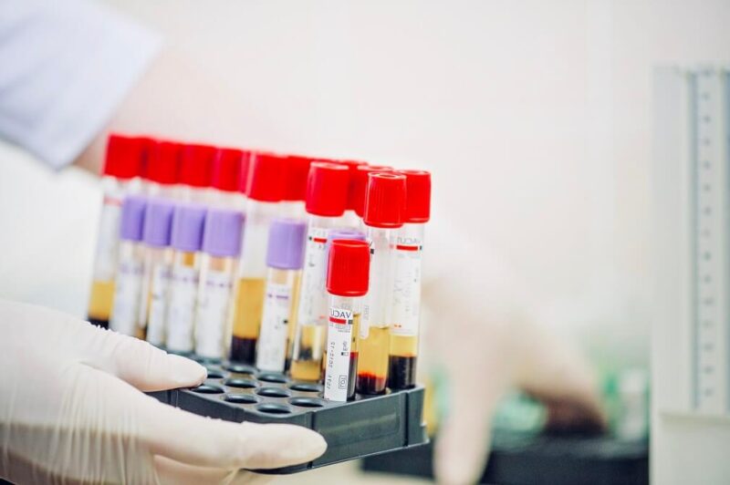 Respiratory Pathogen Panel - Clarity Labs